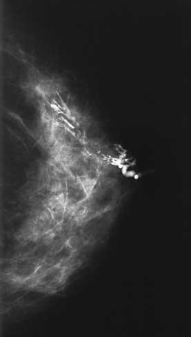 Gallery: Image (422)