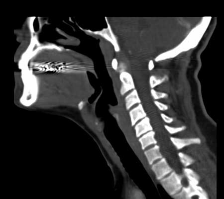 Gallery: Image (174)